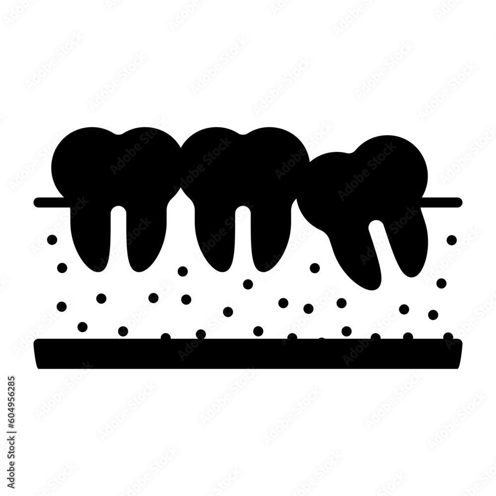 Vector de Stock Misaligned wisdom teeth concept, Third molar tooth ...