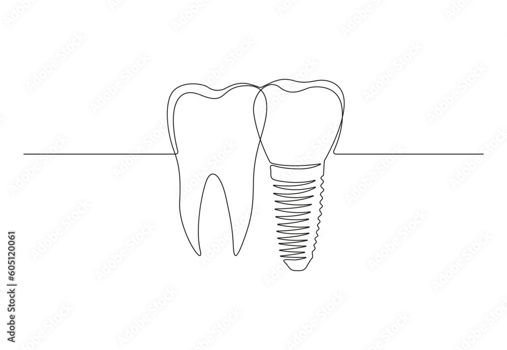 Vector de Stock Single continuous line art anatomical human tooth ...