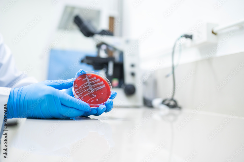 Doctor holding white bacteria on blood agar in hospital microbiology ...