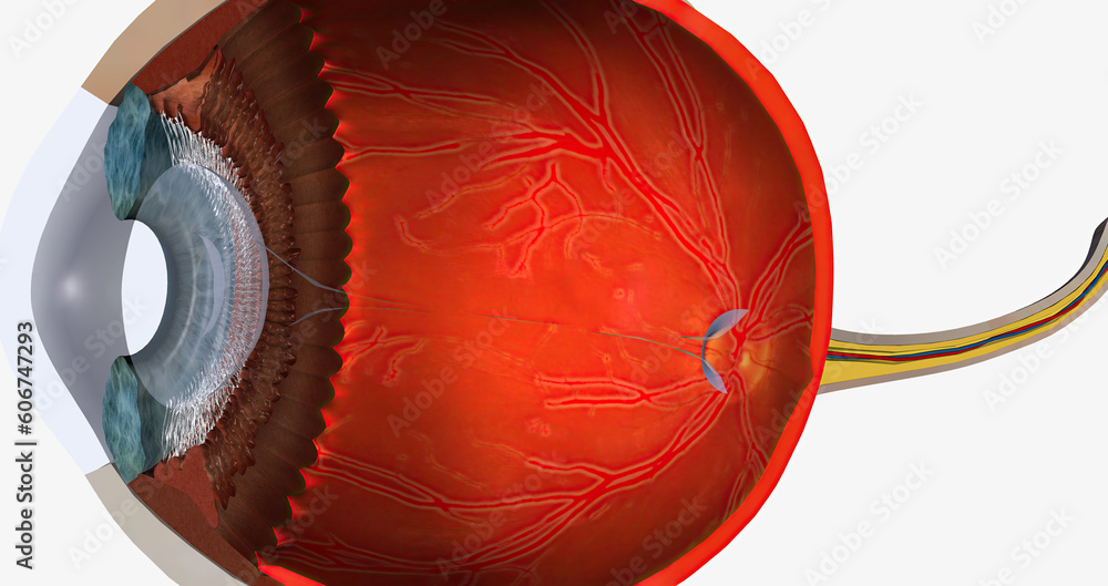 Higher than normal intraocular pressure in the absence of ocular ...