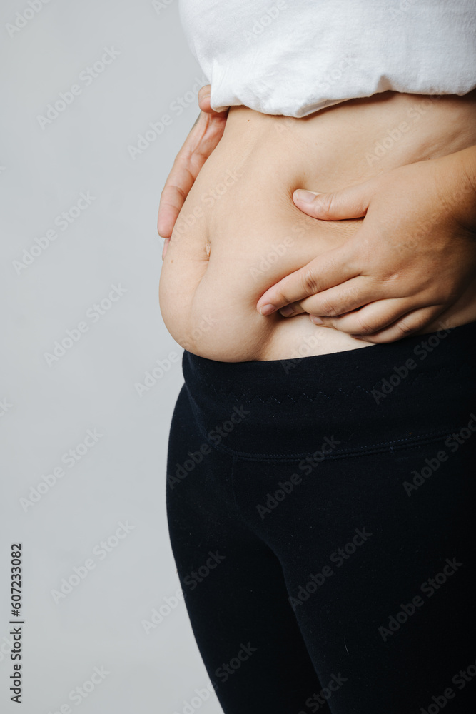 Women with abdominal fat, obesity problems, fat accumulation, diet ...