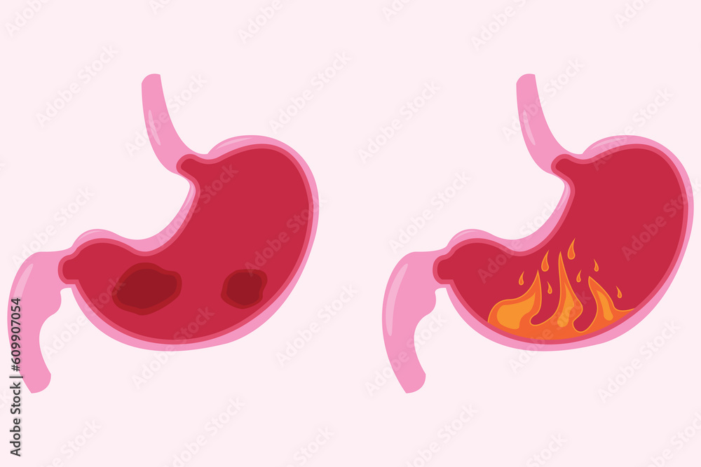Vector de Stock Stomach icon set, cartoon vector illustration. cross ...