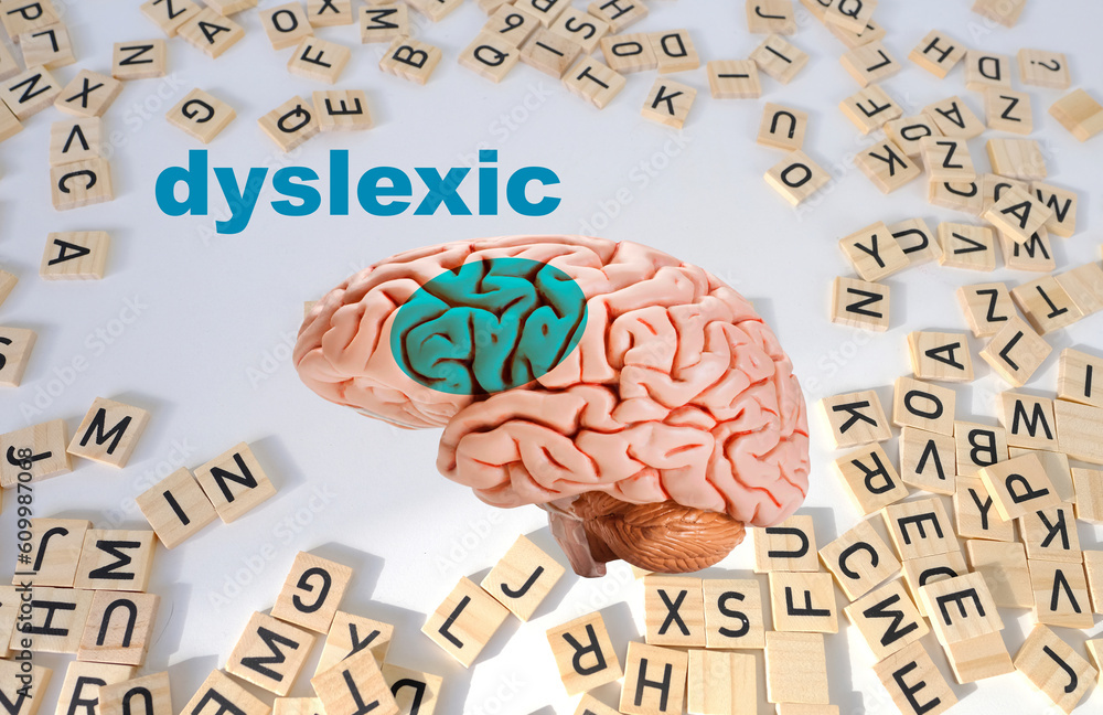 Neural Signature in human brain for Dyslexia, Disruption of Posterior ...