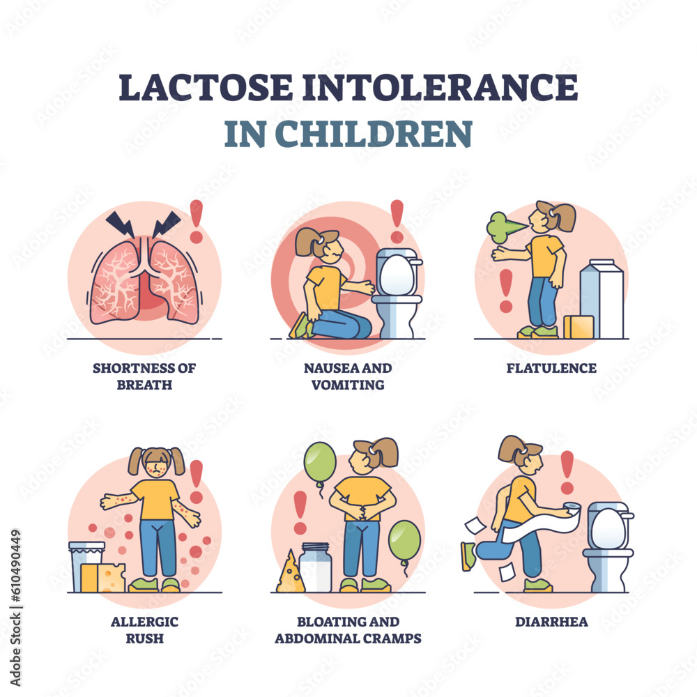 Lactose intolerance in children from milk or dairy allergy outline diagram. Labeled educational ...