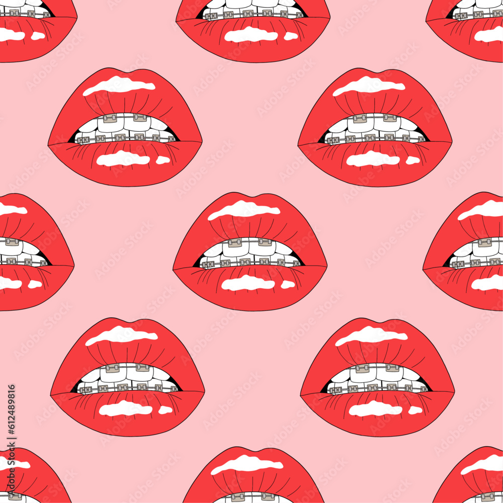 Seamless pattern with sexy lips. Theeth with braces. Funky open mouth ...