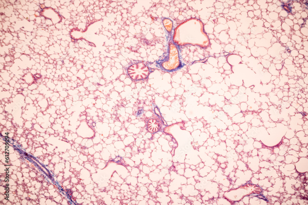 Human lung pathology under light microscope, The lungs is organs of the ...