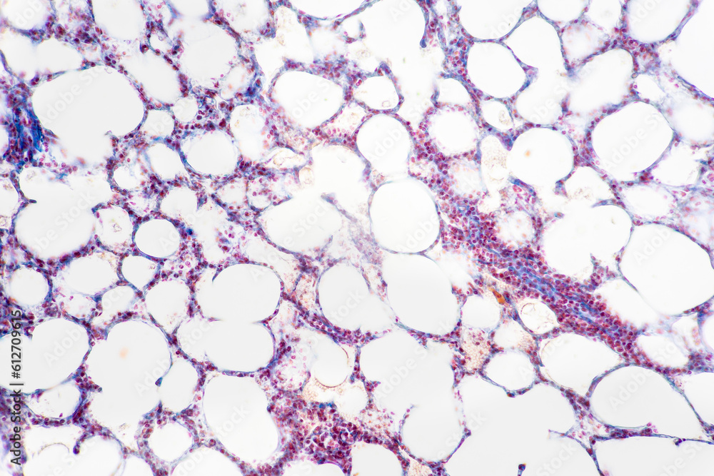 Human lung pathology under light microscope, The lungs is organs of the ...