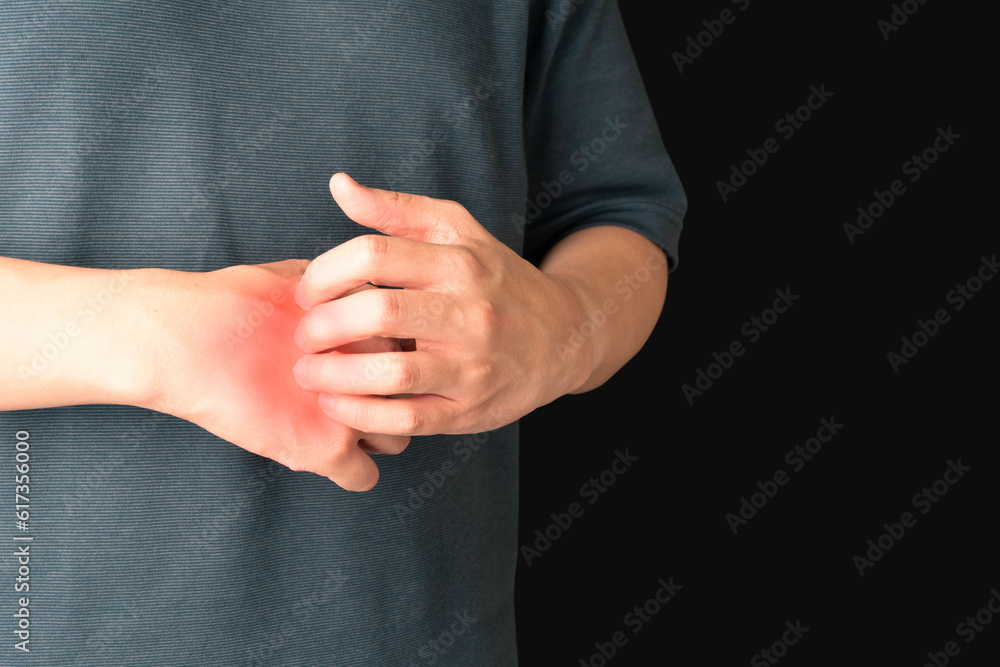 Man scratching the itch on him hands with redness rash. Cause of itchy ...