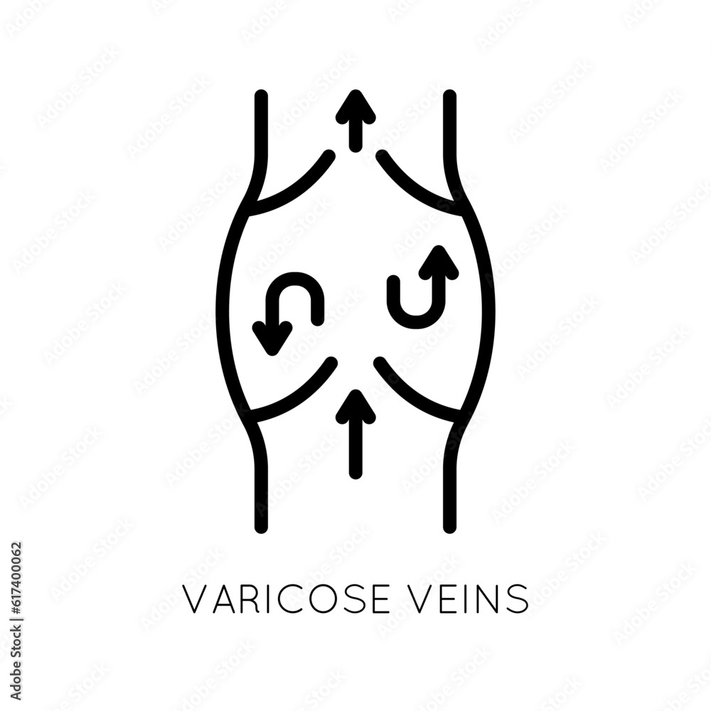 Varicose veins icon. Swelling of the vein, improper blood circulation ...