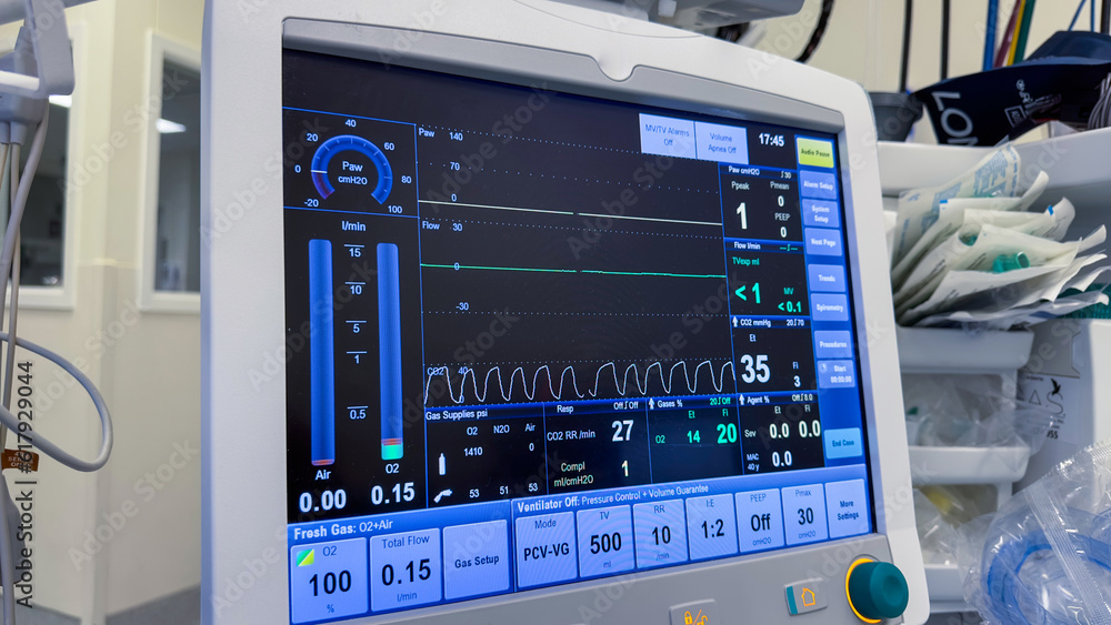 Medical vital signs monitor displaying critical health metrics - blood ...