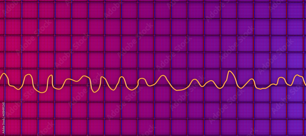 Electrocardiogram ECG displaying ventricular fibrillation rhythm, 3D ...
