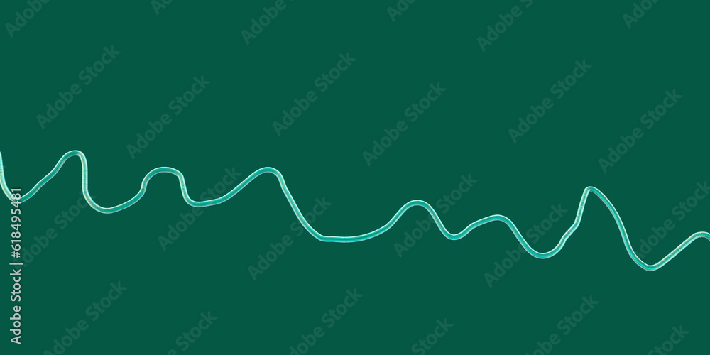 Electrocardiogram ECG displaying ventricular fibrillation rhythm, 3D ...