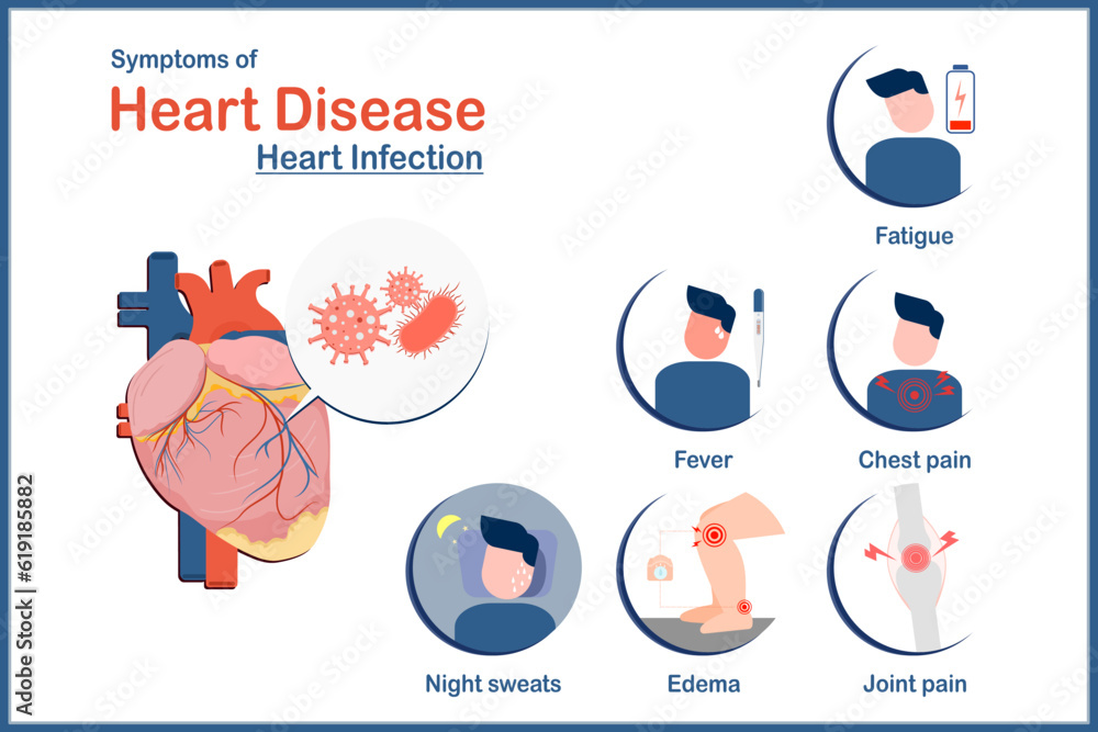 Medical illustration concept, heart disease symptoms caused by ...