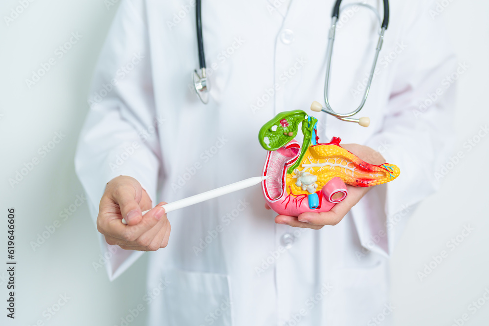 Doctor with human Pancreatitis anatomy model with Pancreas, Gallbladder ...