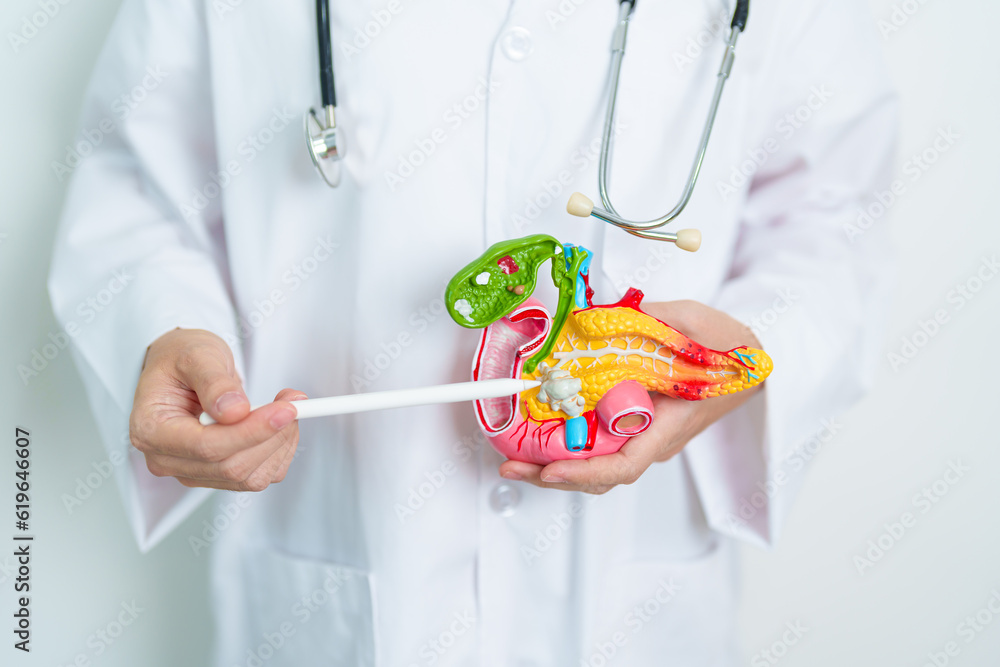 Doctor with human Pancreatitis anatomy model with Pancreas, Gallbladder ...