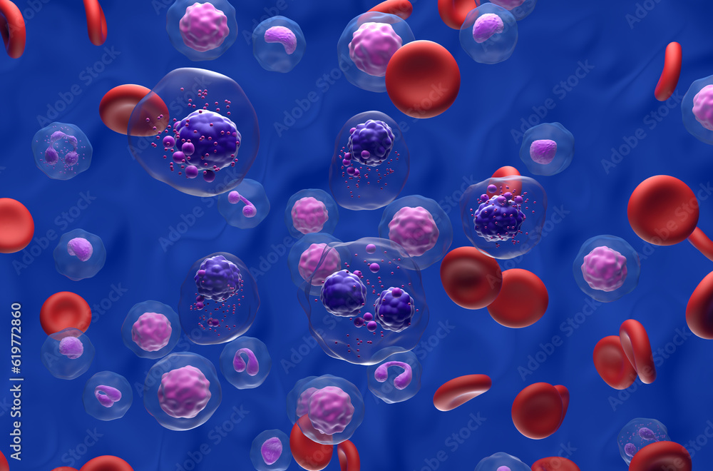 Ilustración de Stock Multiple myeloma cells cluster in the blood flow ...