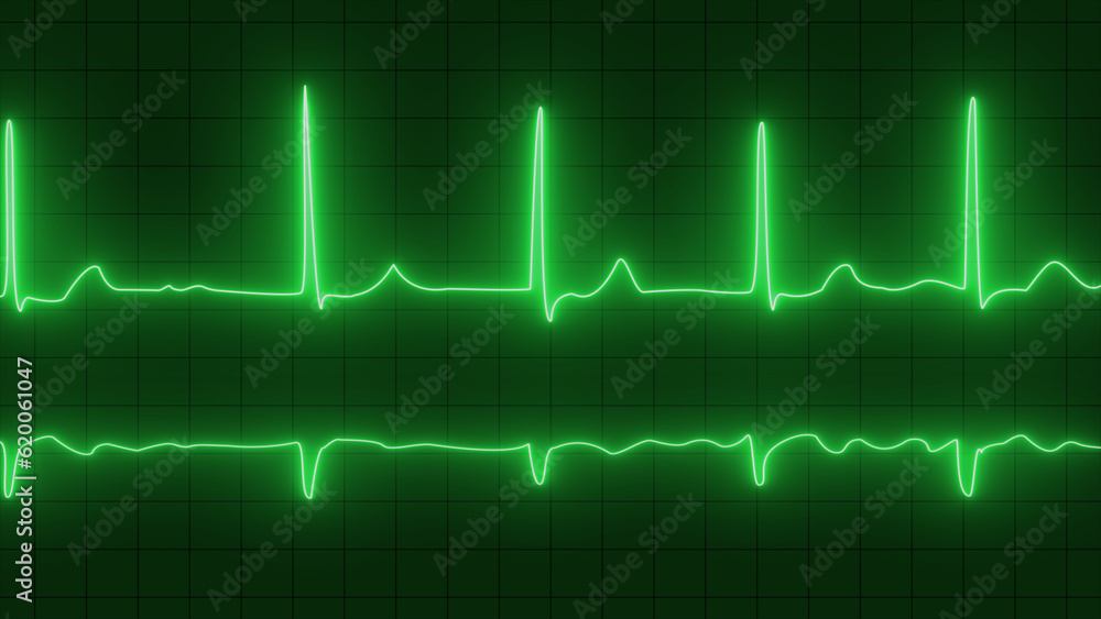 ECG or EKG pulse heartbeat green line symbol on black background ...