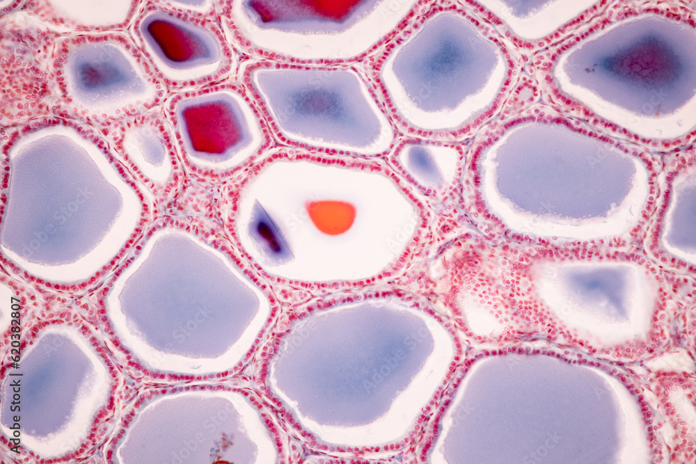 Showing Light micrograph of the Thyroid gland and Thymus gland human ...