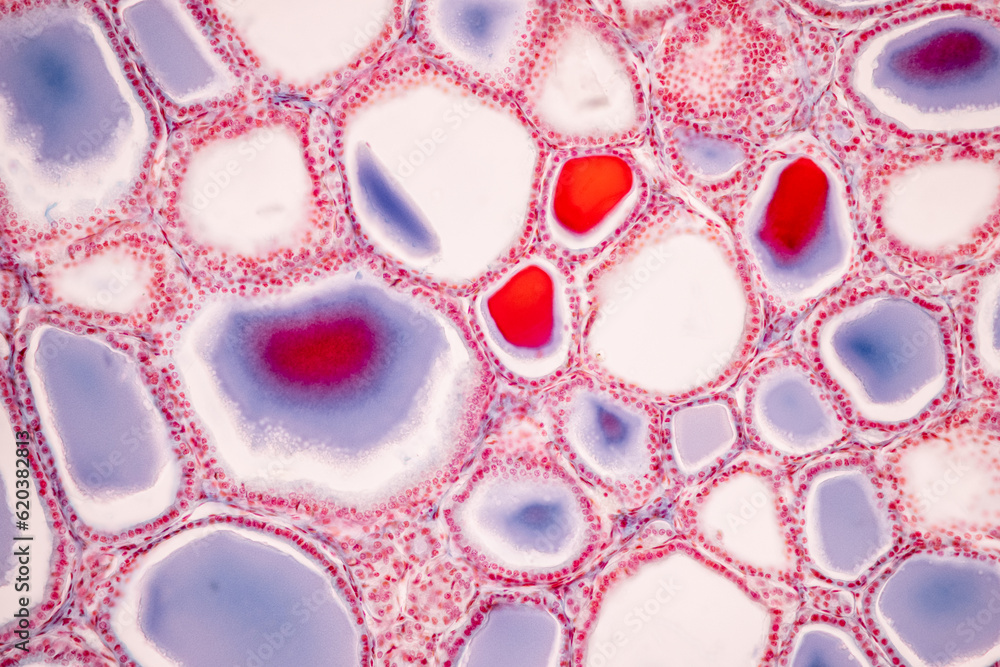 Showing Light micrograph of the Thyroid gland and Thymus gland human ...