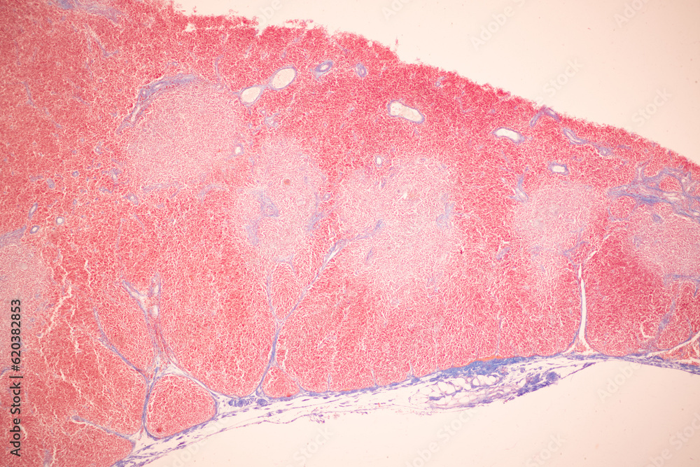 Showing Light micrograph of the Thyroid gland and Thymus gland human ...