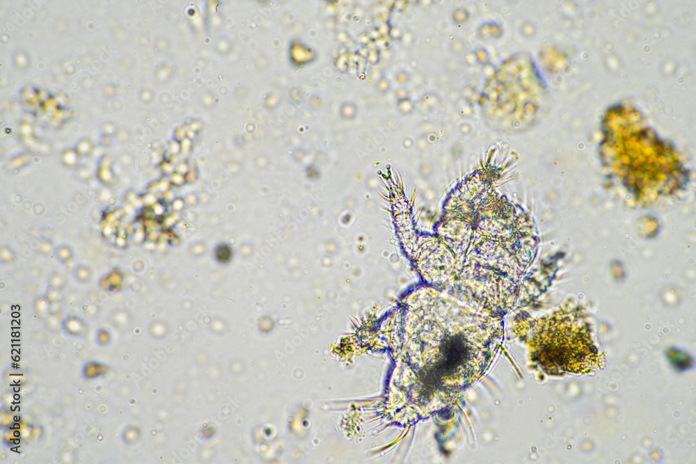 micro arthropods,soil microbes organisms in a soil and compost sample ...