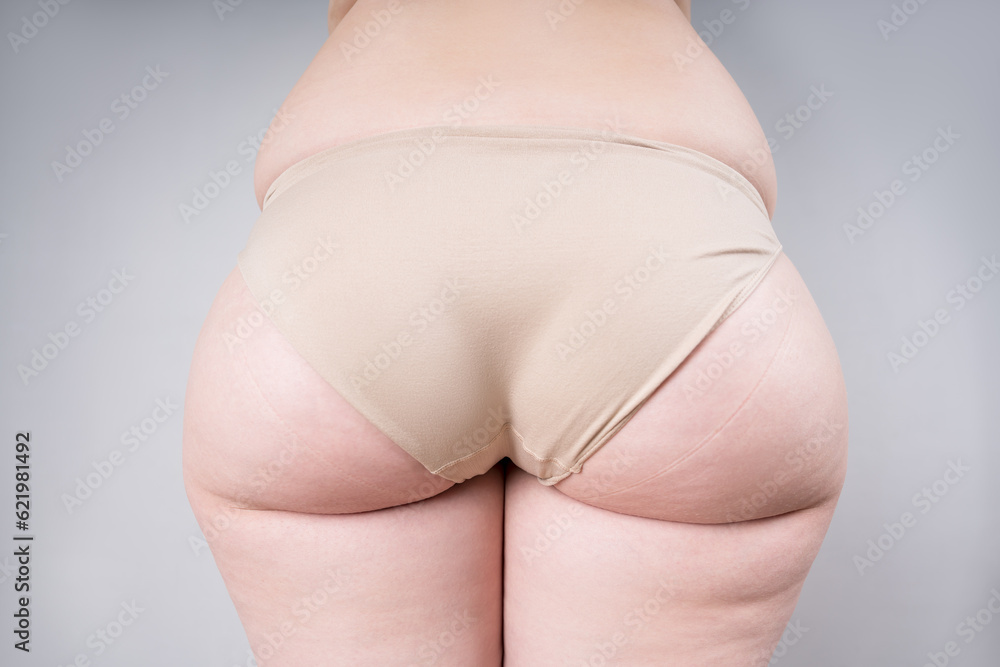 Overweight thigh, woman with fat hips and buttocks, obesity female body with cellulite on gray ...