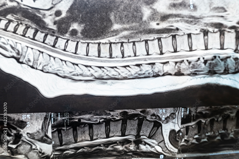 My spine MRI. Medical, science and education mri spine background. MRI ...