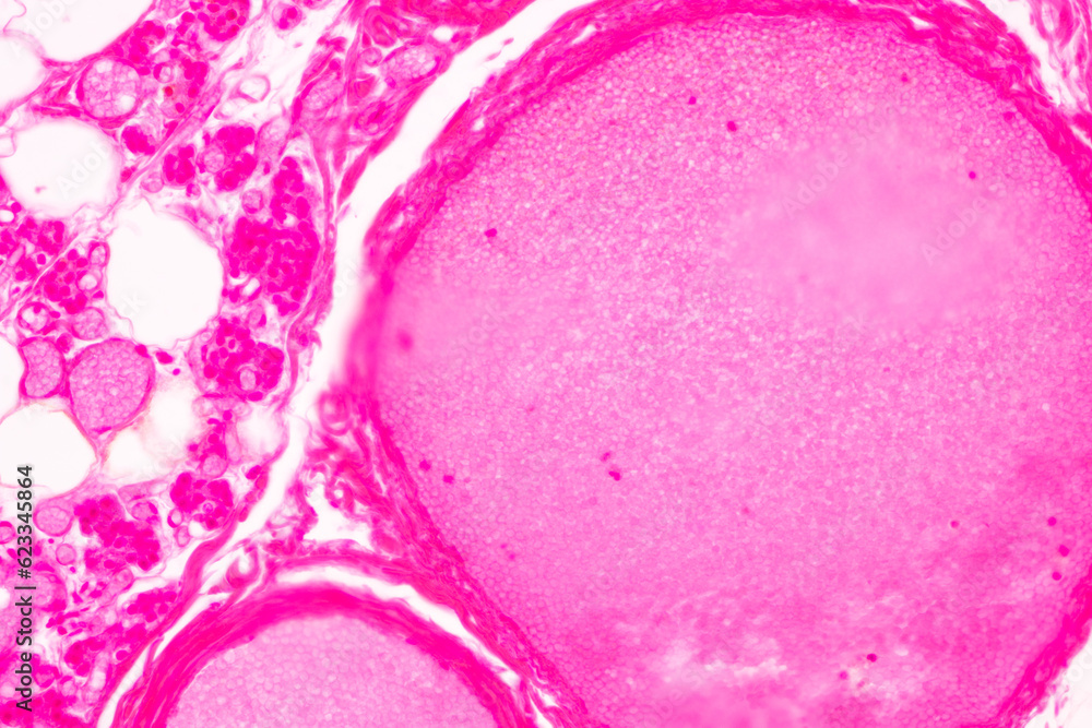 Showing Light micrograph of the Trachea, Thymus, Parathyroid gland and ...