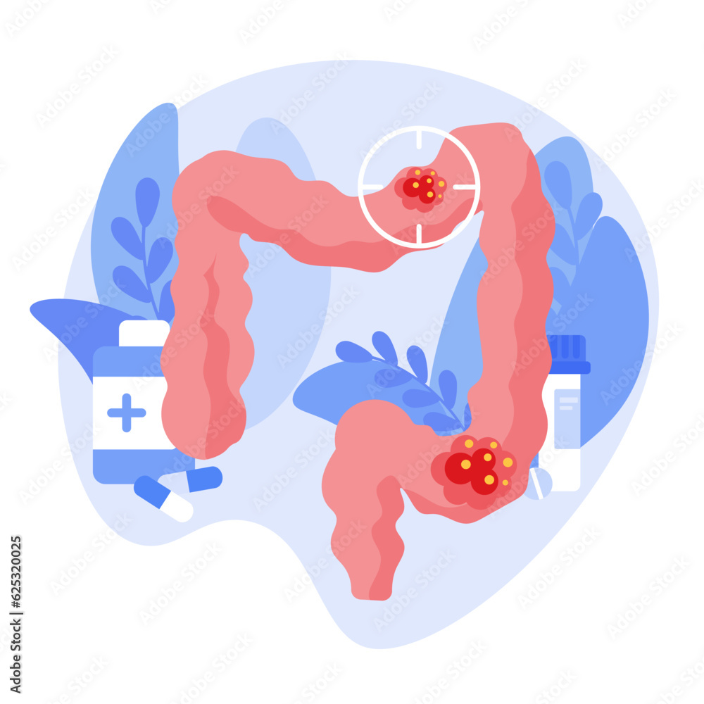 Pain or inflammation in the intestines. Anatomy of the intestine ...