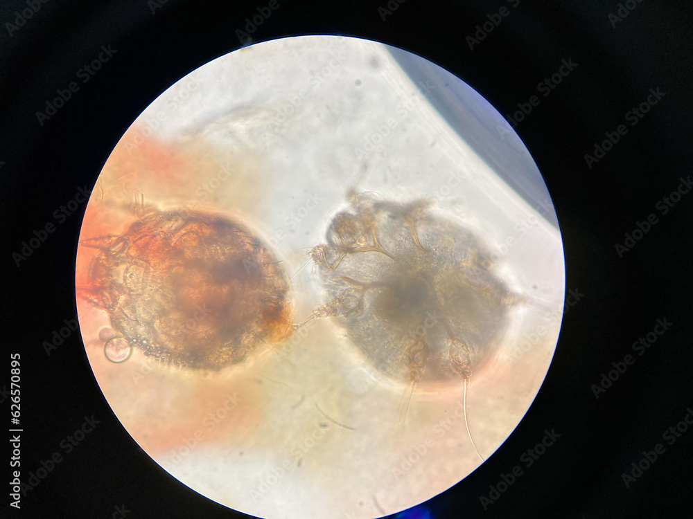 Notoedres cati under the microscope. Notoedric mange, also referred to ...