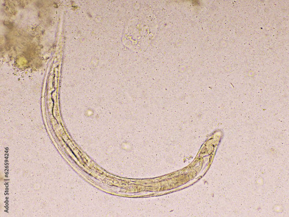 Strongyloides stercoralis or threadworm in human stool, analyze by ...