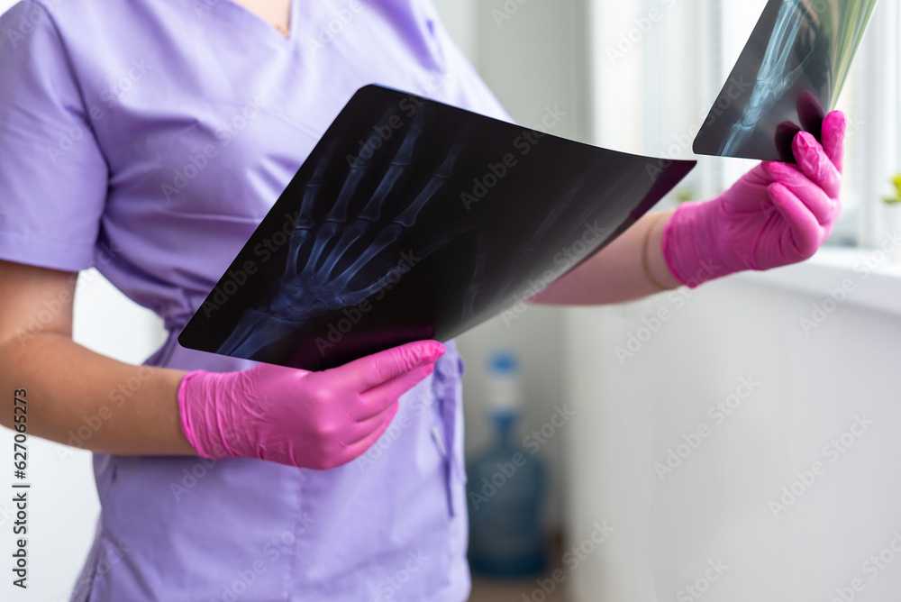 Young woman doctor looking at xray radiography images at clinic ...