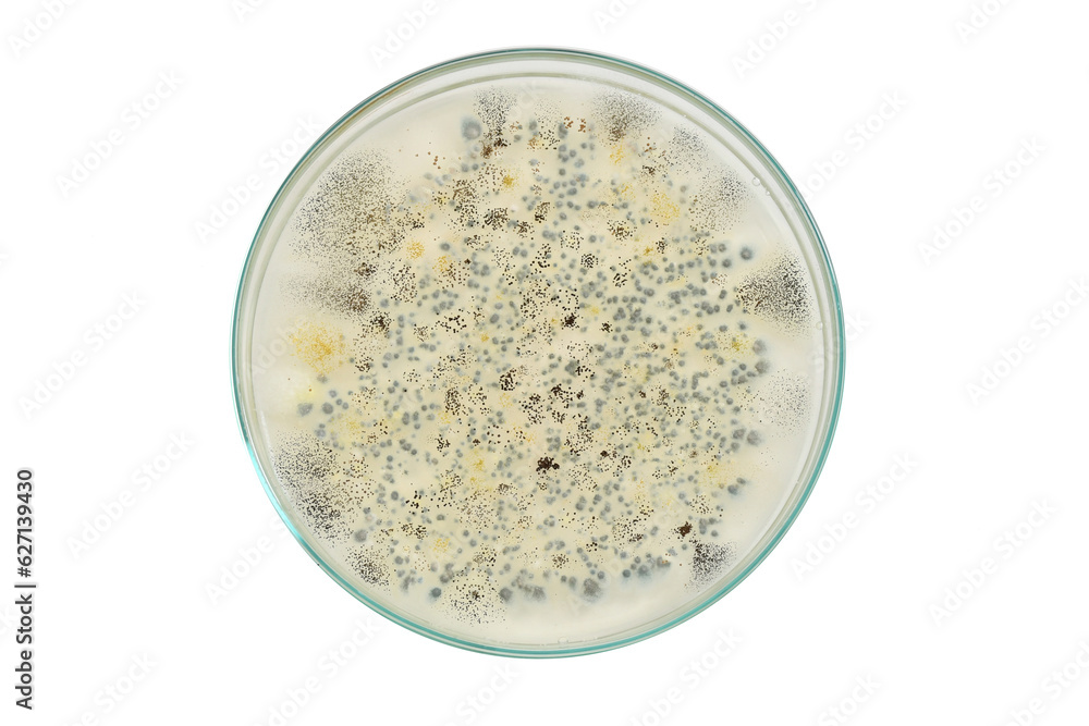 Colony morphology of Yeast and mould. Fungal colony morphology. Fungal ...