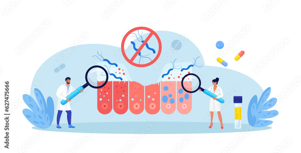Helicobacter pylori infection. Bacterium with flagella damage stomach ...