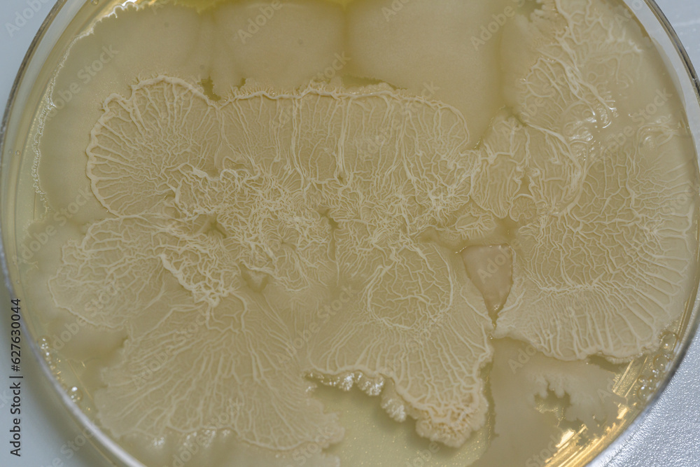 Close up media plate with bacteria culture and drug resistance of ...