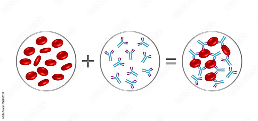 Hemagglutination. Clumping of Red Blood Cells, RBCs. Scientific design ...