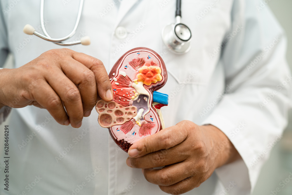 Kidney disease, Chronic kidney disease ckd, Doctor hold model to study ...