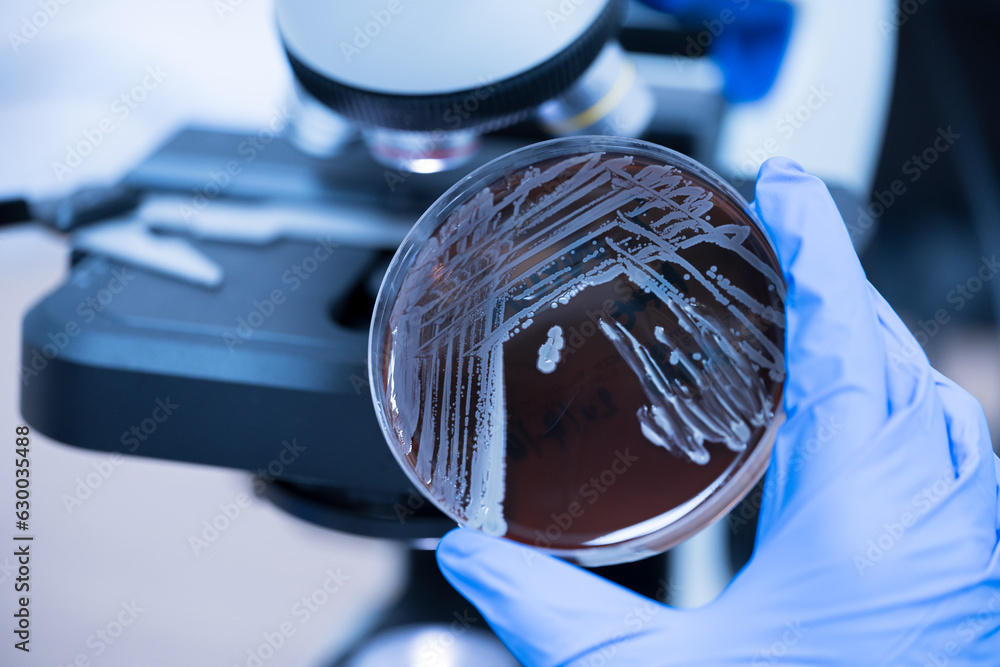 Scientist holding agar plate for diagnosis bacterial or microorganism ...