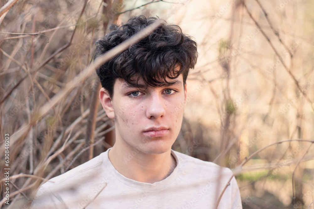 Pimples on the face of a young teenage boy, he is sad, uncomfortable ...