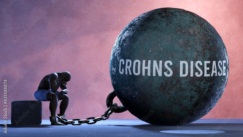 Ilustración de Stock Crohns disease - a metaphor showing human struggle ...