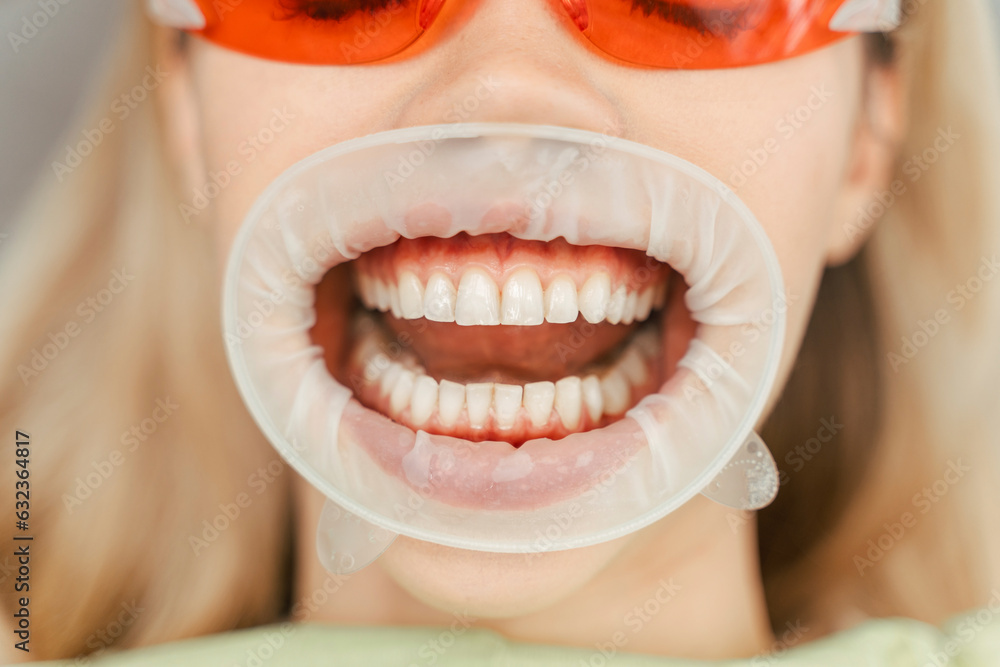 Young attractive woman with blonde hair in red glasses with open mouth ...