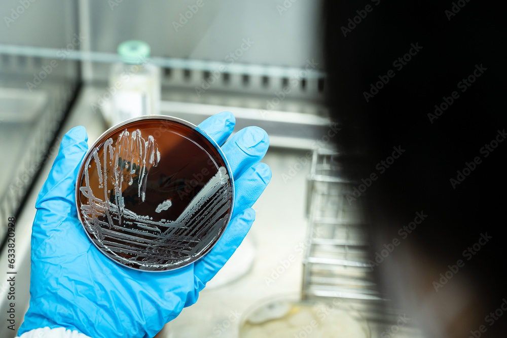 Scientist hand wearing blue gloves hold agar plate for diagnosis ...