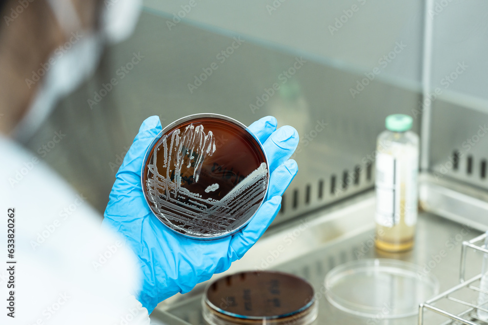 Scientist hand wearing blue gloves hold agar plate for diagnosis ...