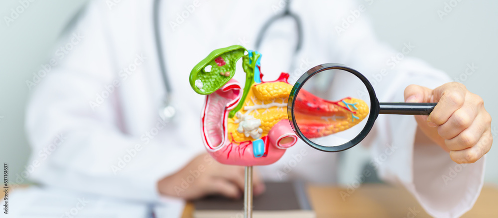 Doctor with human Pancreatitis anatomy model with Pancreas, Gallbladder ...