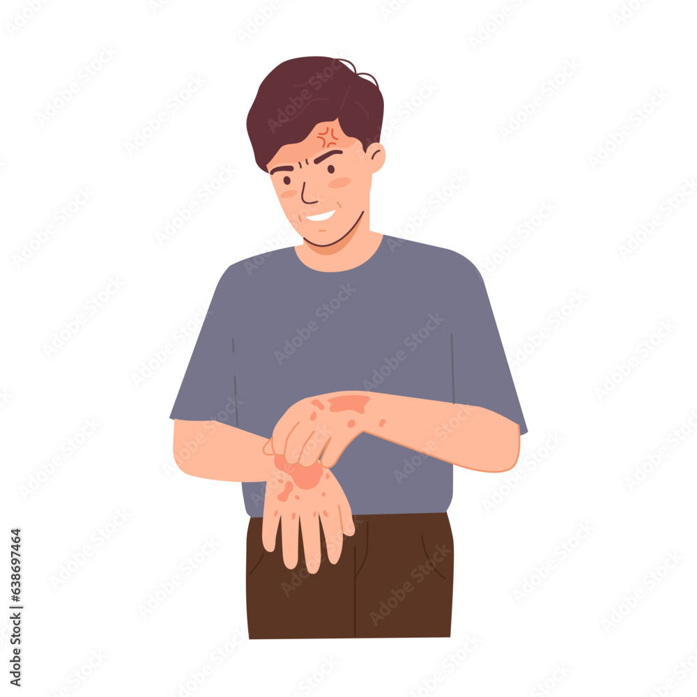 Man scratching his hand with skin disease problem. Rash on hands from ...