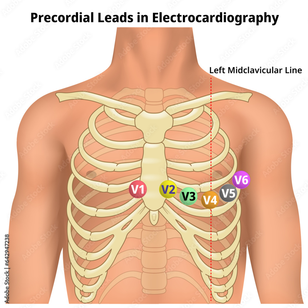 Vetor Precordial Leads in Electrocardiography - V1, V2, V3, V4, V5, and ... Vetor Precordial Leads in Electrocardiography - V1, V2, V3, V4, V5, and ...