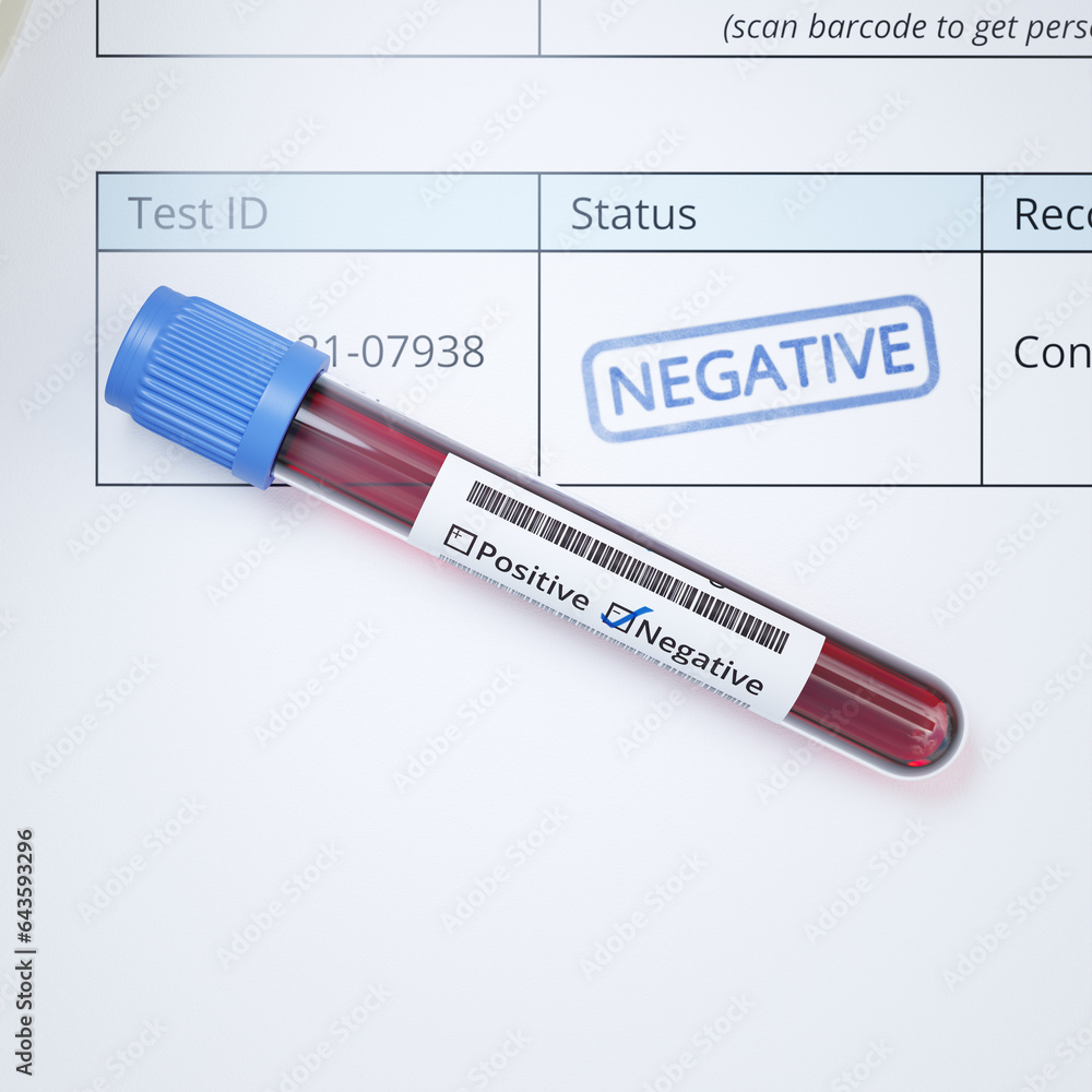 Negative test of a blood sample. Viral infection. Patient documents ...