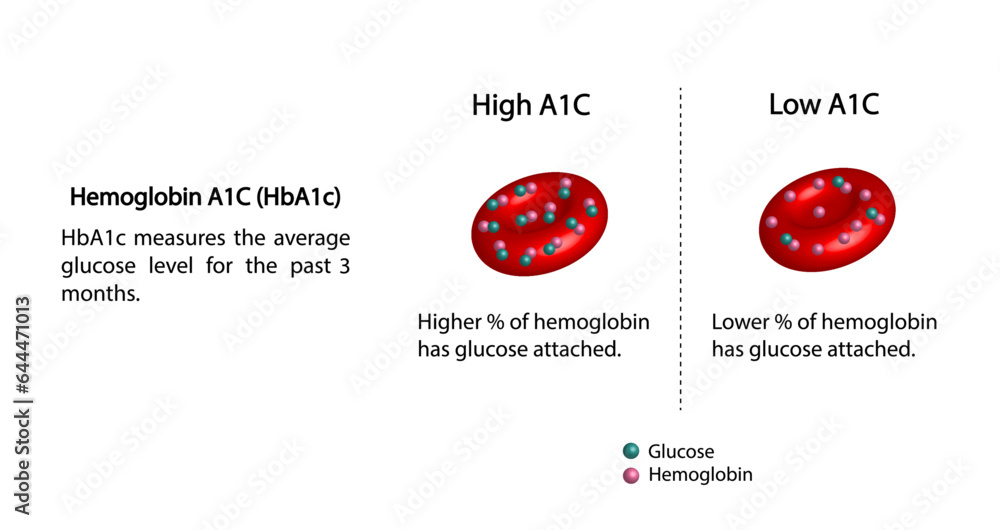 Hemoglobin A1C, HbA1c test , HbA1c levels, Glucose sticks to hemoglobin ...