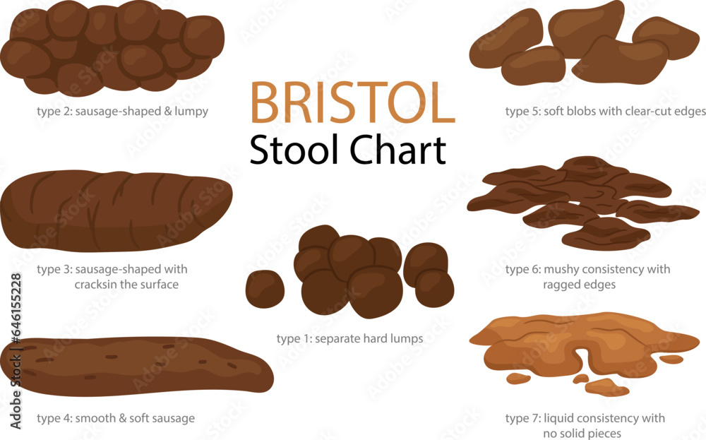 Стоковий вектор Bristol stool form scale with faeces type images. Set ...