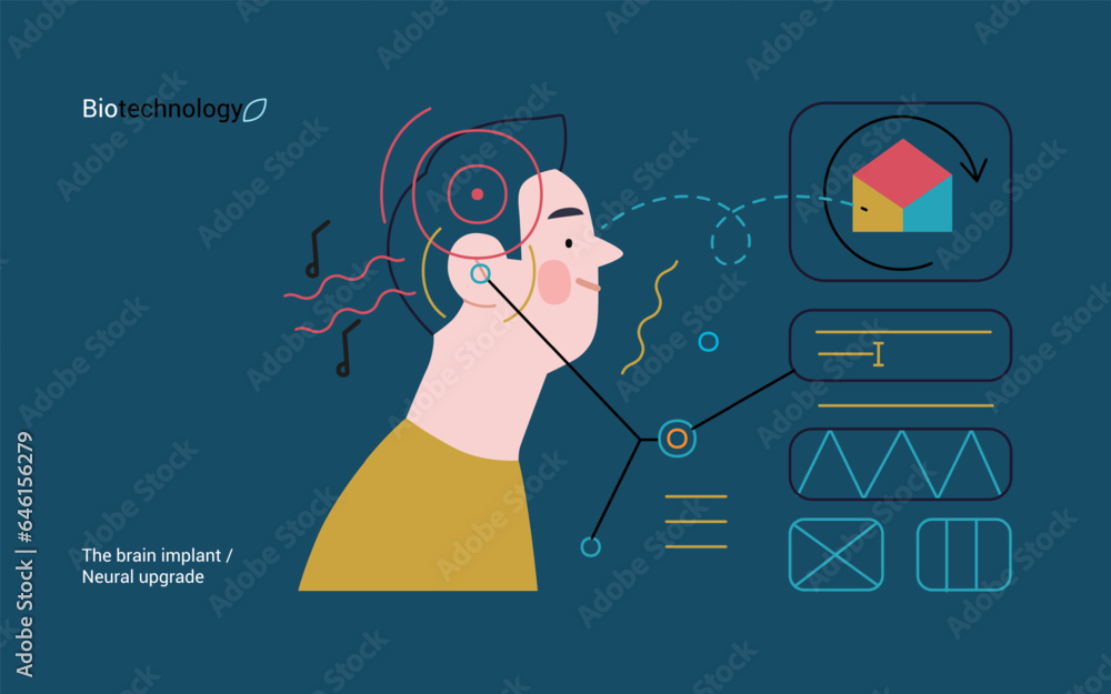 Bio Technology, Brain implant, Neural upgrade -modern flat vector concept illustration of brain ...